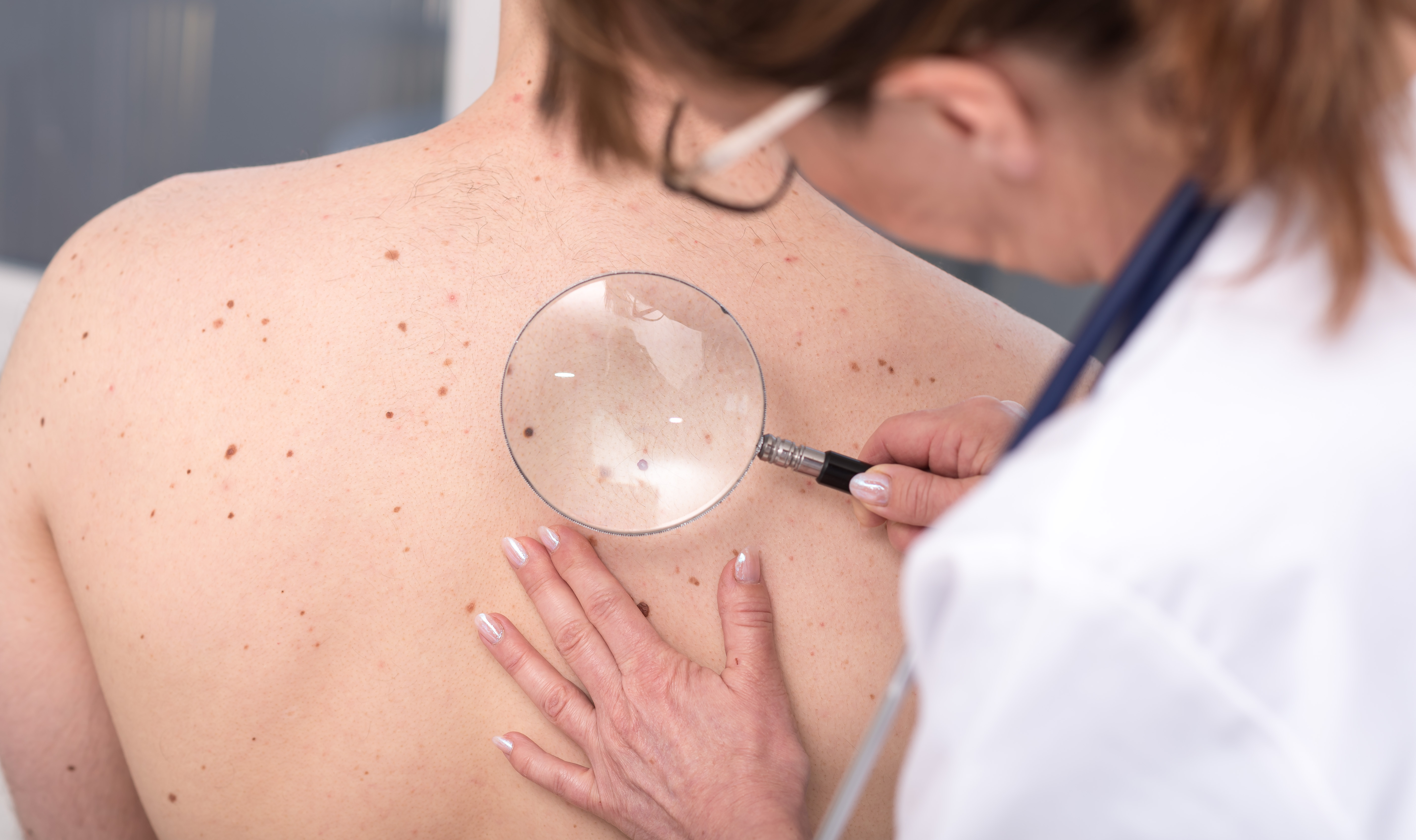 U.S. Preventive Services Task Force calls for more research on skin ...